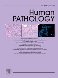 Subscribe to Human Pathology - 0046-8177 | Elsevier Shop | Elsevier Shop