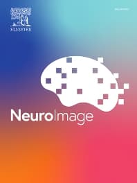 Subscribe to NeuroImage - 1053-8119 | Elsevier Shop | Elsevier Shop