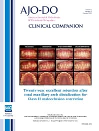 Subscribe to AJO-DO Clinical Companion - 2666-4305 | Elsevier Shop