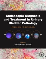 Endoscopic Diagnosis and Treatment in Urinary Bladder Pathology - 1st ...