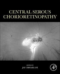 Central Serous Chorioretinopathy - 1st Edition | Elsevier Shop