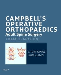 Campbell's Operative Orthopaedics: Adult Spine Surgery E-Book - 12th ...