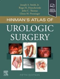 Hinman's Atlas of Urologic Surgery - 5th Edition | Elsevier Shop