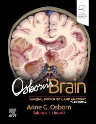Osborn's Brain - 3rd Edition | Elsevier Shop