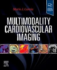 Multimodality Cardiovascular Imaging - 1st Edition | Elsevier Shop