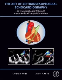 The Art of 2D Transesophageal Echocardiography - 1st Edition | Elsevier Shop