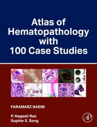 Atlas of Hematopathology with 100 Case Studies - 1st Edition | Elsevier ...