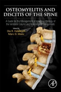 Osteomyelitis and Discitis of the Spine - 1st Edition | Elsevier Shop