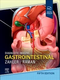 Diagnostic Imaging: Gastrointestinal - 5th Edition | Elsevier Shop