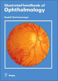 Illustrated Handbook of Ophthalmology - 1st Edition | Elsevier Shop