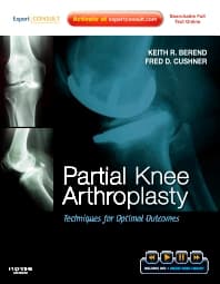 Partial Knee Arthroplasty - 1st Edition | Elsevier Shop